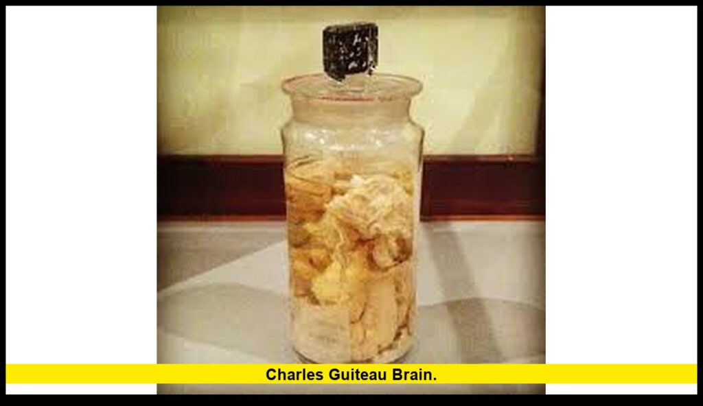 Charles Guiteau Brain: A Detailed, Fully Factual Look at Its ...