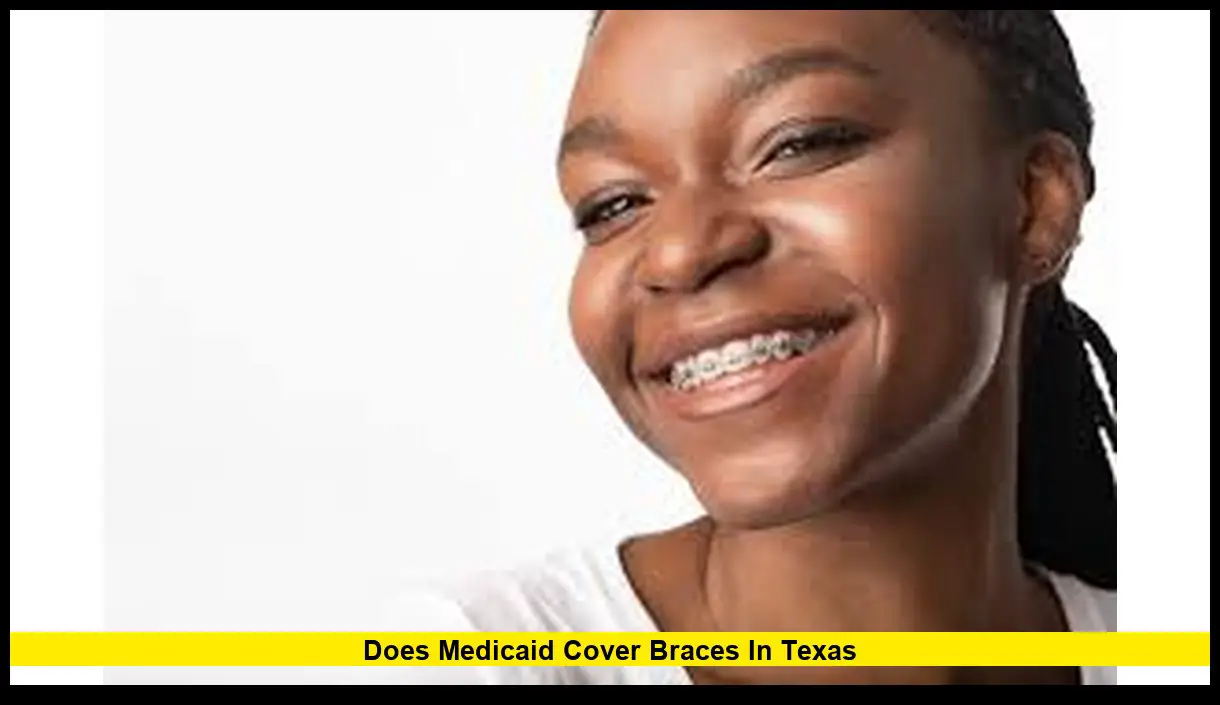 Does Medicaid Cover Braces in Texas: 2026 Eligibility, Coverage Rules ...