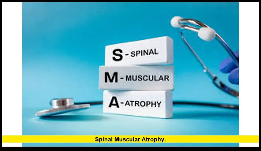 Spinal Muscular Atrophy: Latest U.S. Updates, Treatments, Research, and ...