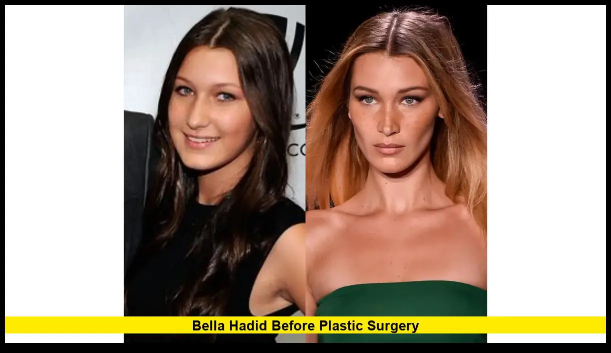 Bella Hadid Before Plastic Surgery: What Is Fact, What Is Confirmed, and What Her Early Photos Show
