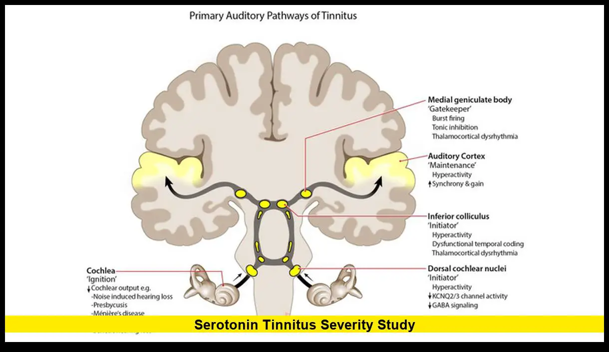 Serotonin Tinnitus Severity Study: New 2026 Findings on Brain Chemistry ...